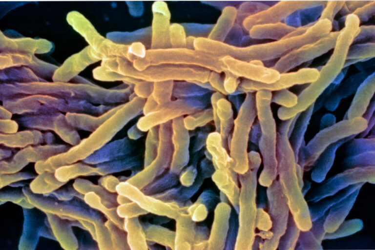 Tuberculosis – UK Health Security Agency