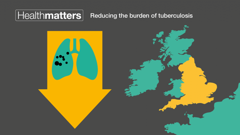 Health Matters: Reducing the burden of tuberculosis – UK Health ...