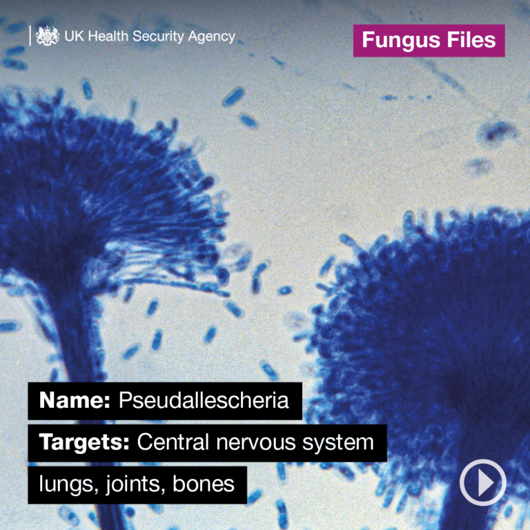 Inside Britain’s Deadly Fungus Collection – UK Health Security Agency