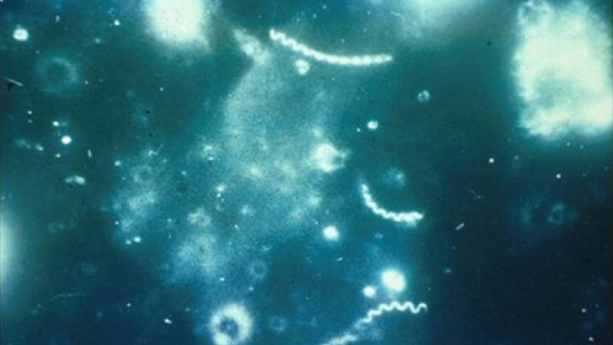 What is syphilis? A quick guide to its symptoms and treatment – UK ...